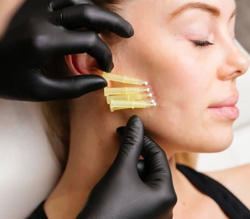 Cog Threads in Delhi – Achieve a Youthful, Lifted Look